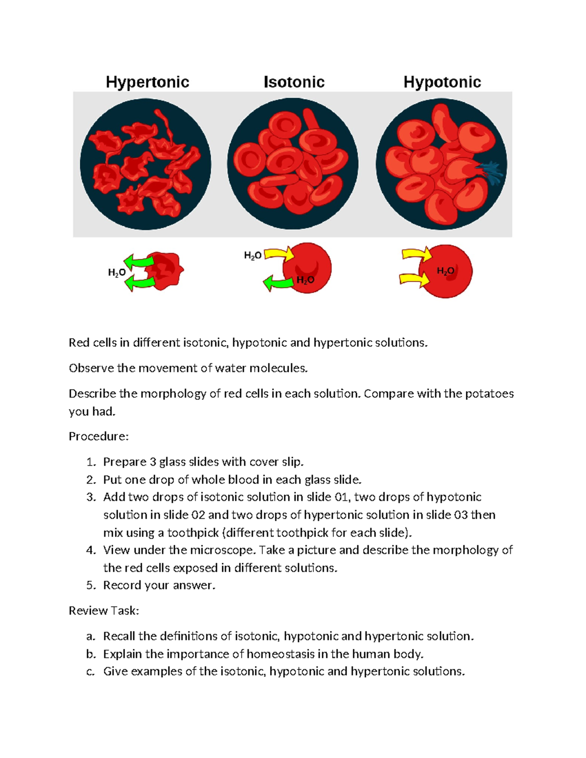 Red cells in isotonic hypotonic and hypertonic solutions - Red cells in ...