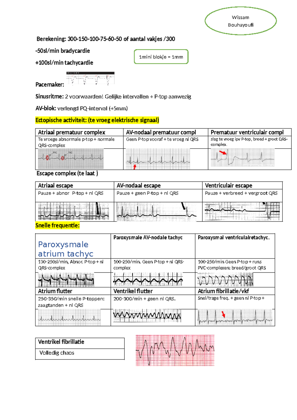 Spiekbriefje ECG - spiekbrief - Berekening: 300-150-100-75-60-50 of ...