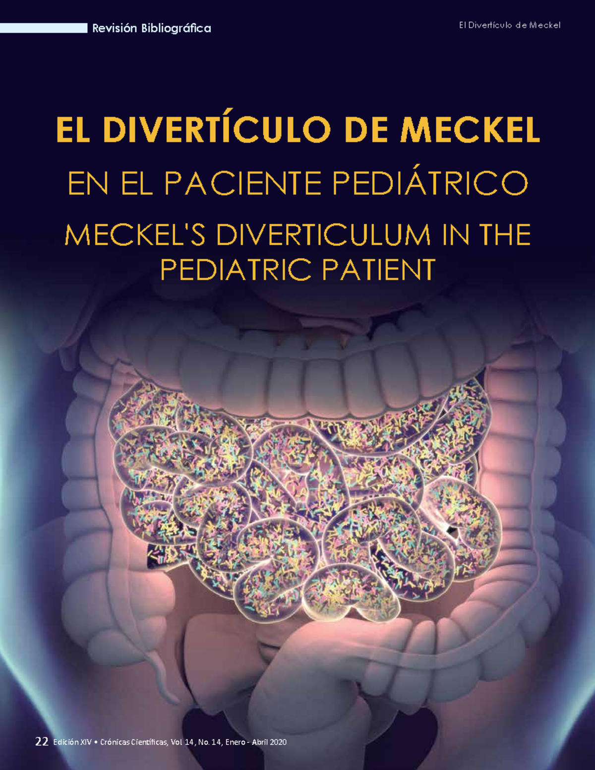 Meckel - EL DIVERTÍCULO DE MECKEL MECKEL'S DIVERTICULUM IN THE ...