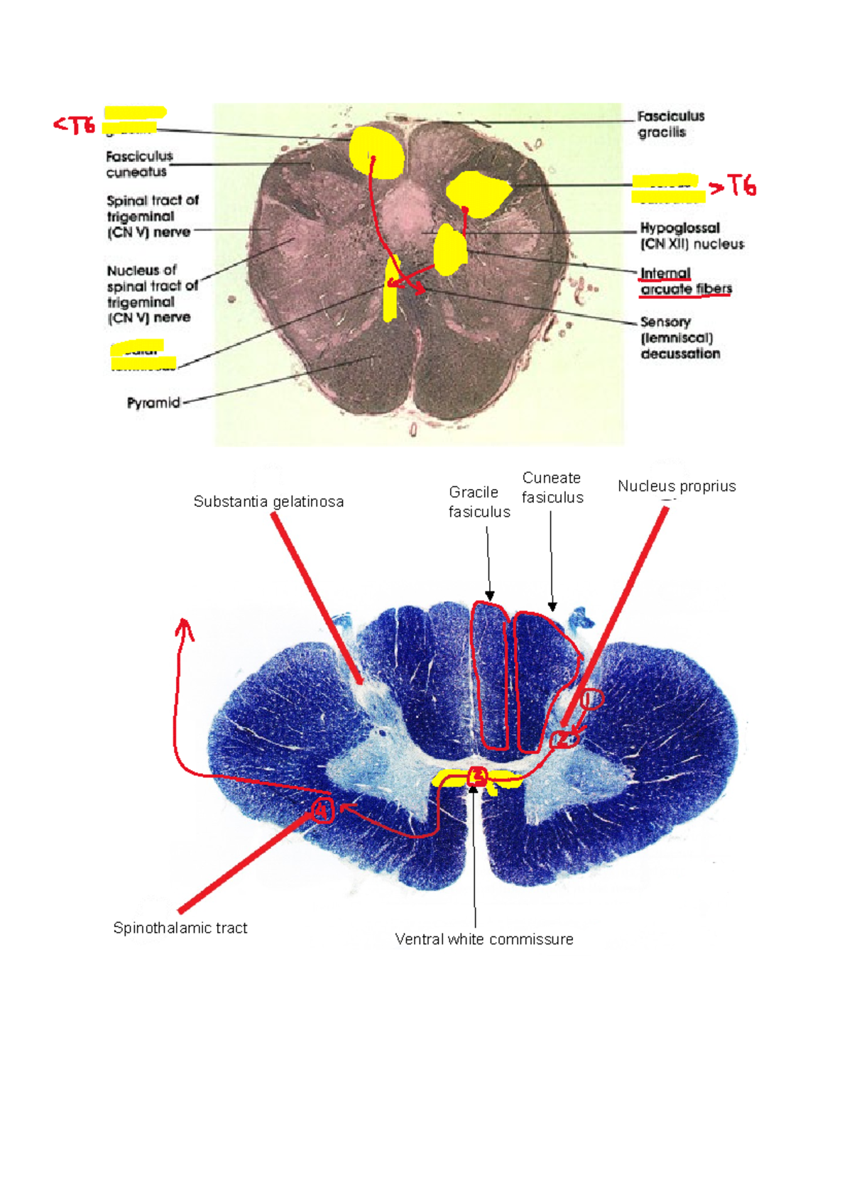 Sensory brainstem and spinal cord sections - NEUR3005 - Substantia gelatinosa Nucleus proprius ...