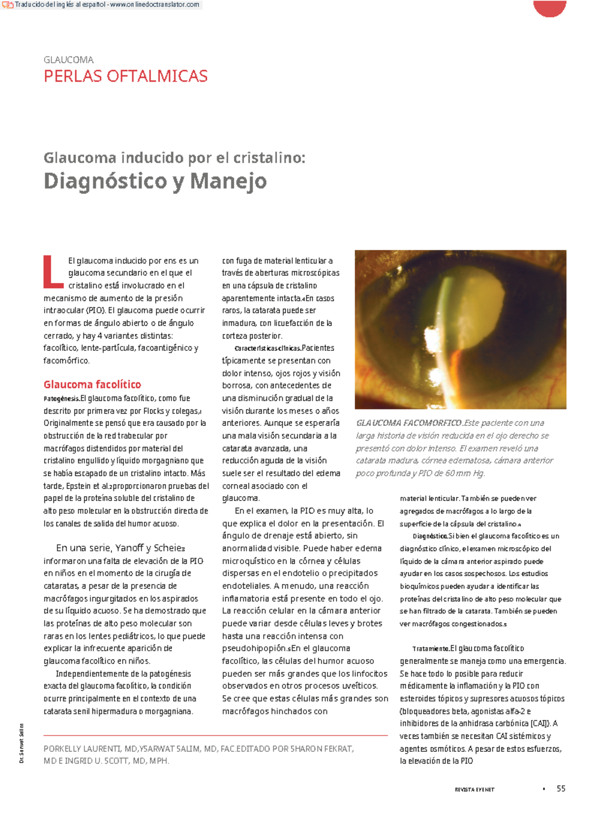 October 2016 Ophthalmic Pearls - GLAUCOMA PERLAS OFTALMICAS Glaucoma inducido por el cristalino ...