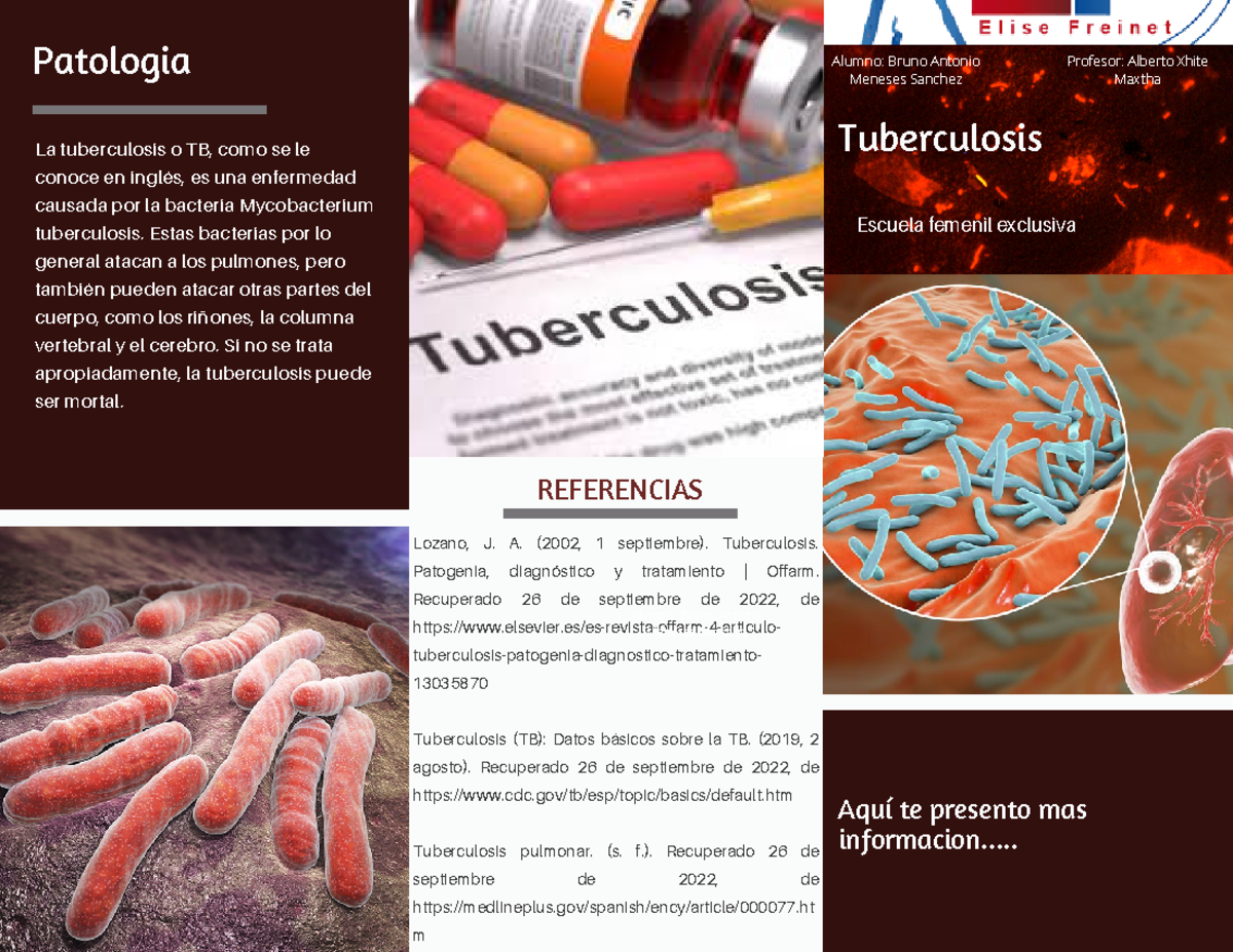 Triptico Tuberculosis - Tuberculosis Escuela femenil exclusiva Aquí te ...