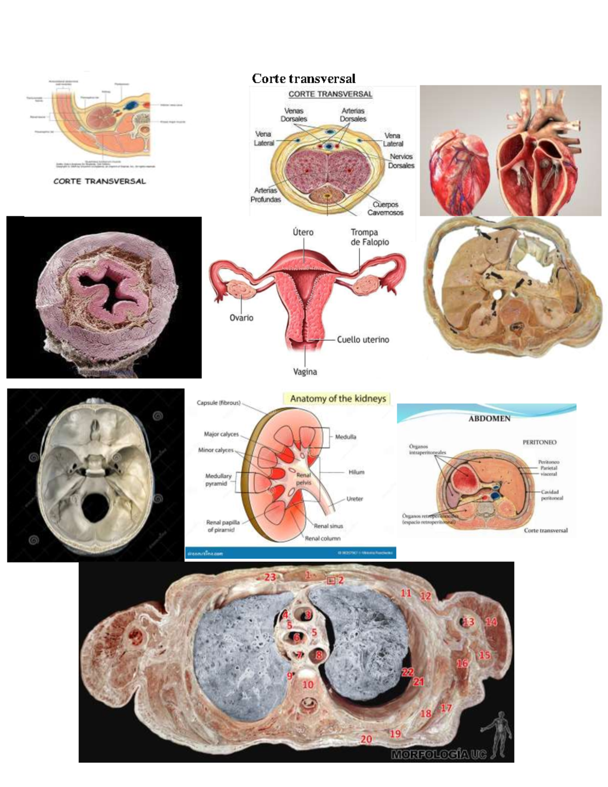 Planos anatomicos - Corte transversal CORTE TRANSVERSAL Venas Arterias ...