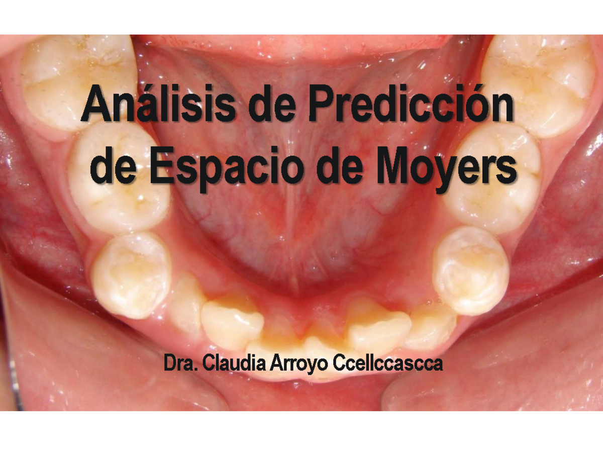 Parte 2 - Análisis de Moyers Claudia Arroyo(1)(2)(3) - Análisis de ...