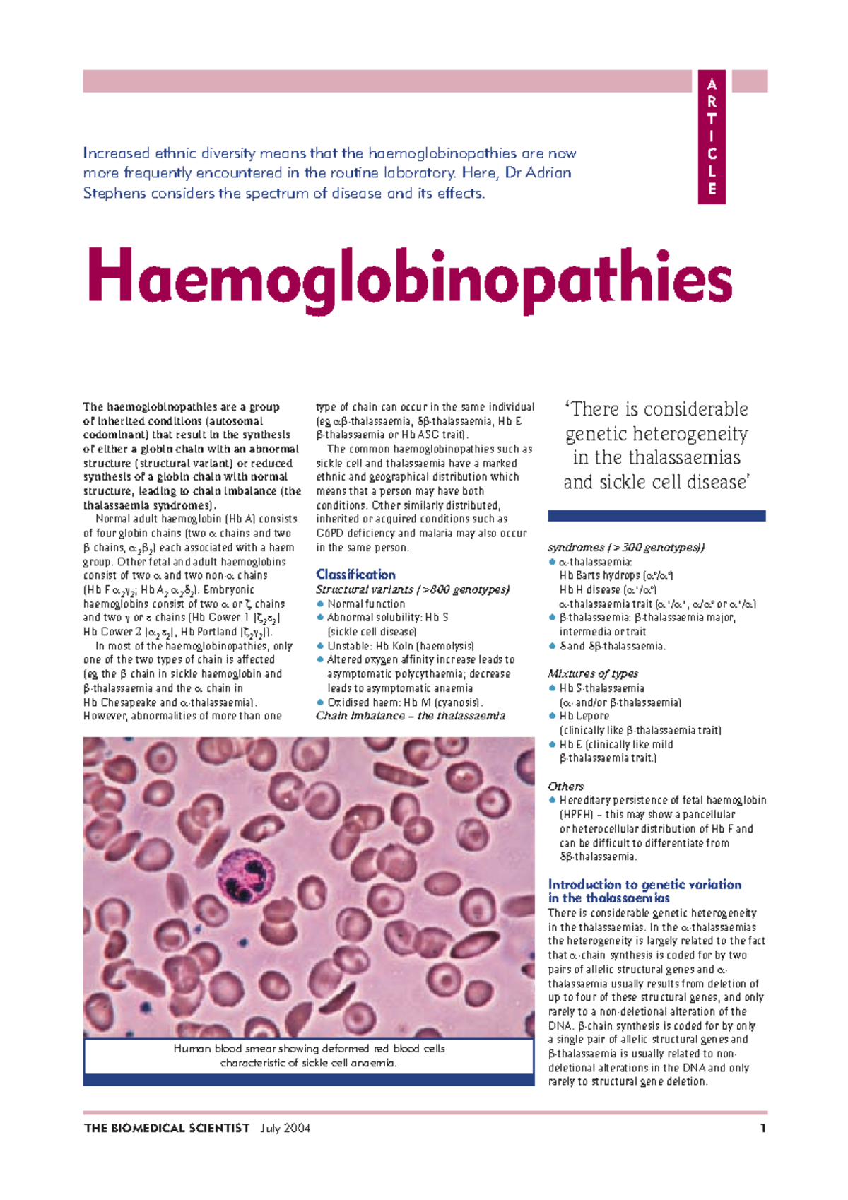 Haemoglobinpathies - Normal adult haemoglobin (Hb A) consists of four ...