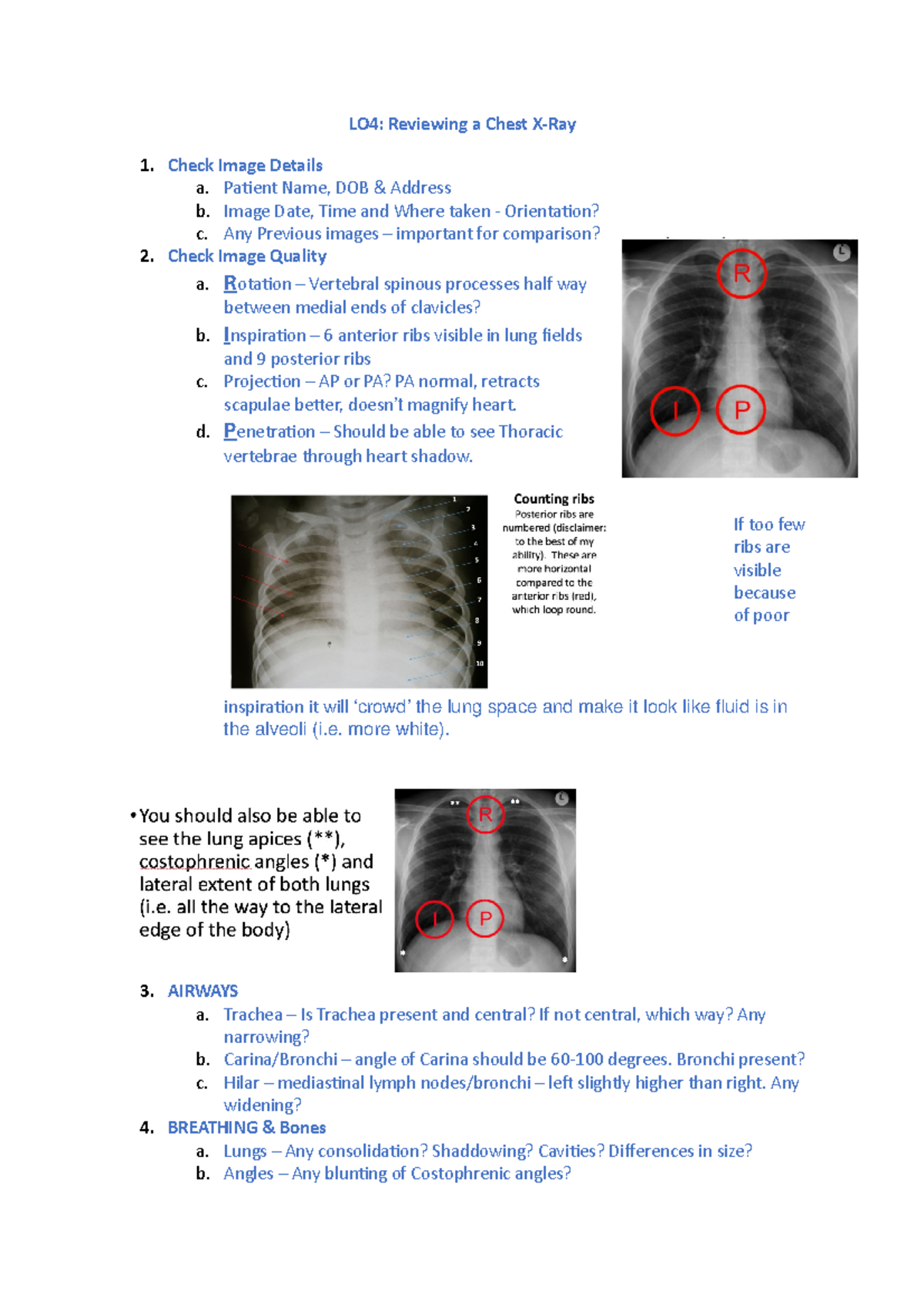 Chest x-ray review - LO4: Reviewing a Chest X-Ray 1. Check Image ...