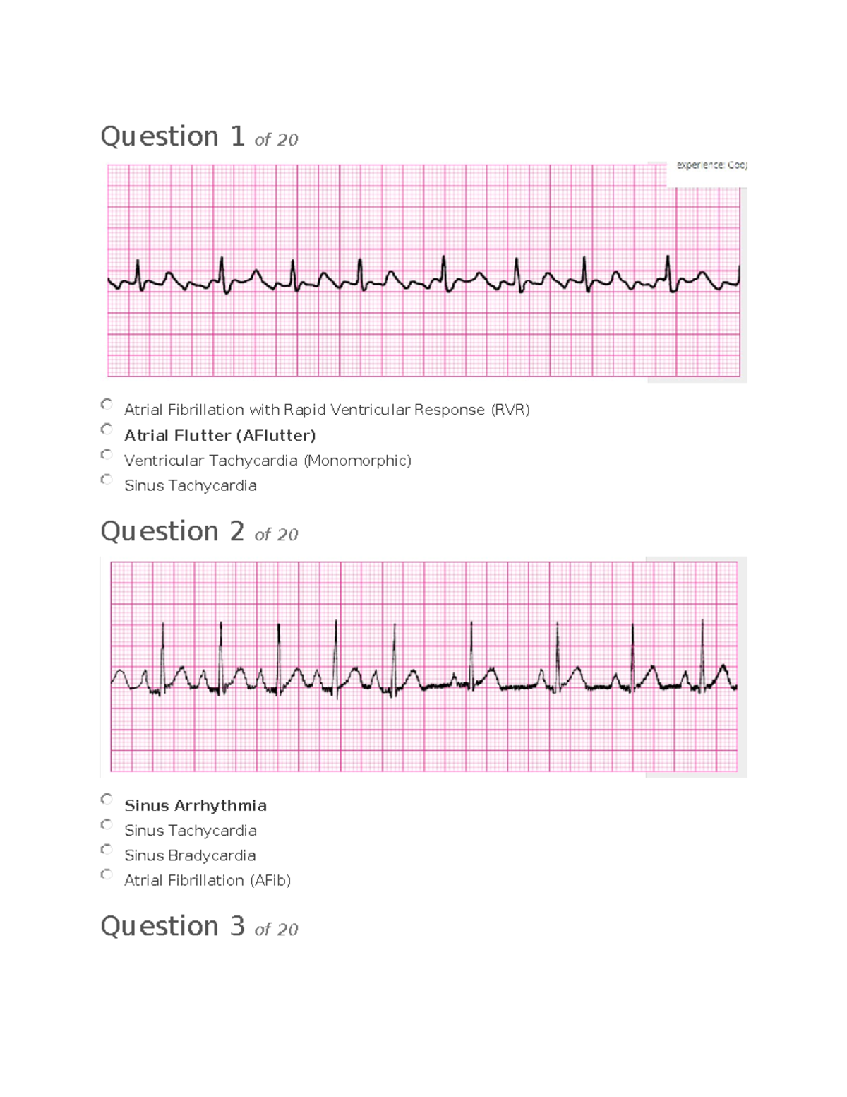 20 cau ekg - Question 1 of 20 Atrial Fibrillation with Rapid ...