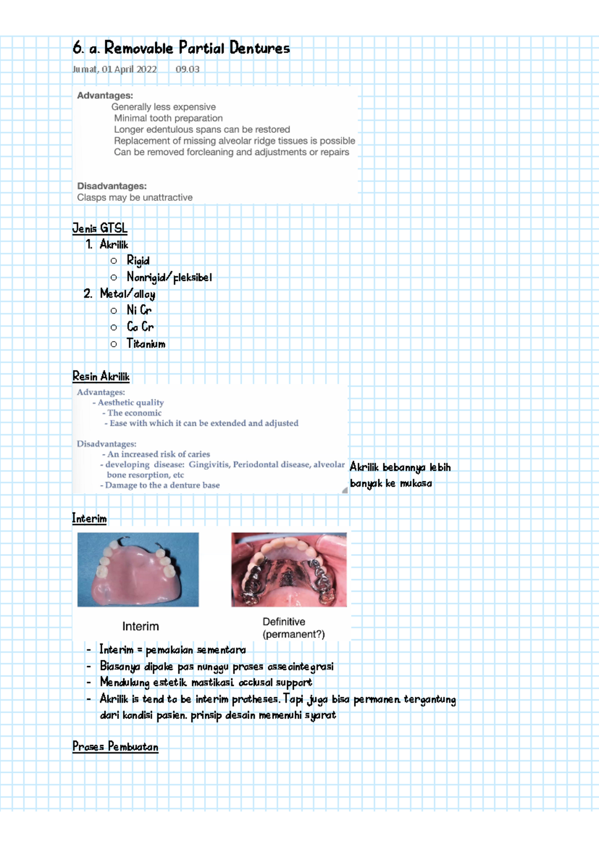 Prostodonsia II - 6. a. Removable Partial Dentures - Jenis GTSL Akrilik Rigid Nonrigid/fleksibel ...