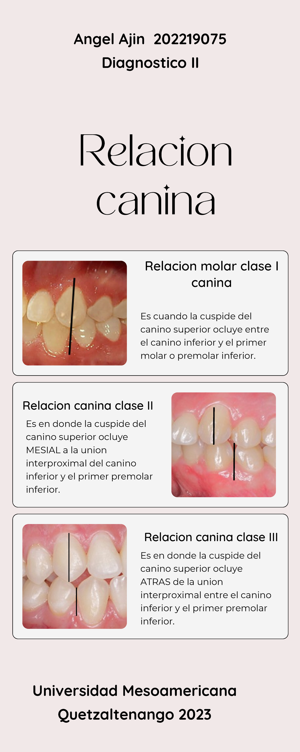 Relacion molar - Es cuando la cuspide del canino superior ocluye entre ...