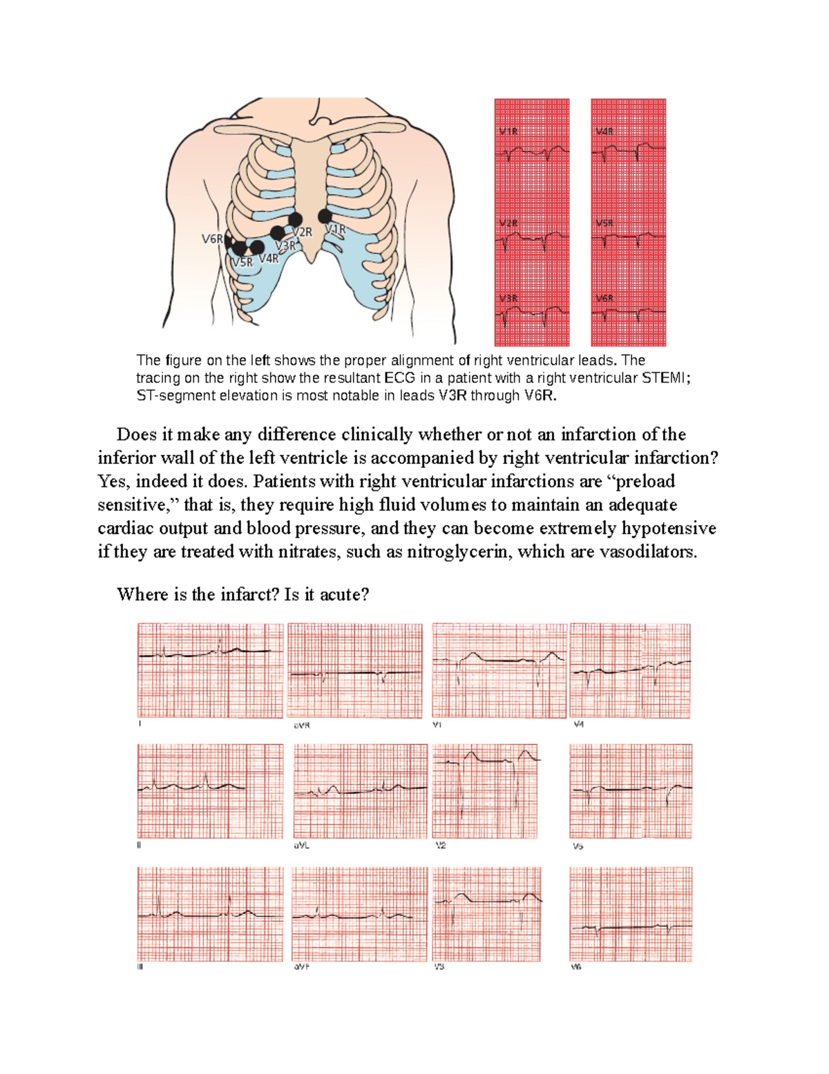 The only EKG-91 - The only EKG - The figure on the left shows the ...