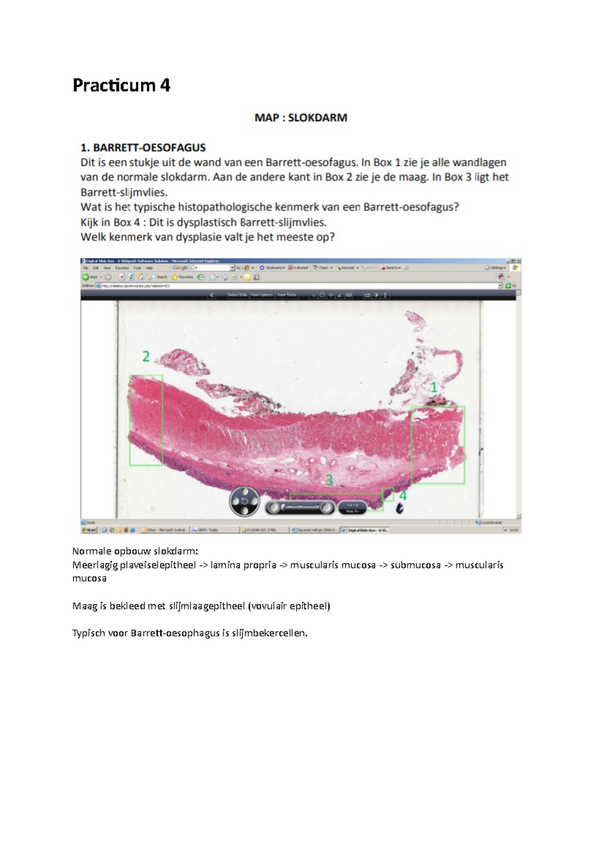 GZC II, Practicum 4 - Practicum 4 Normale opbouw slokdarm: Meerlagig ...