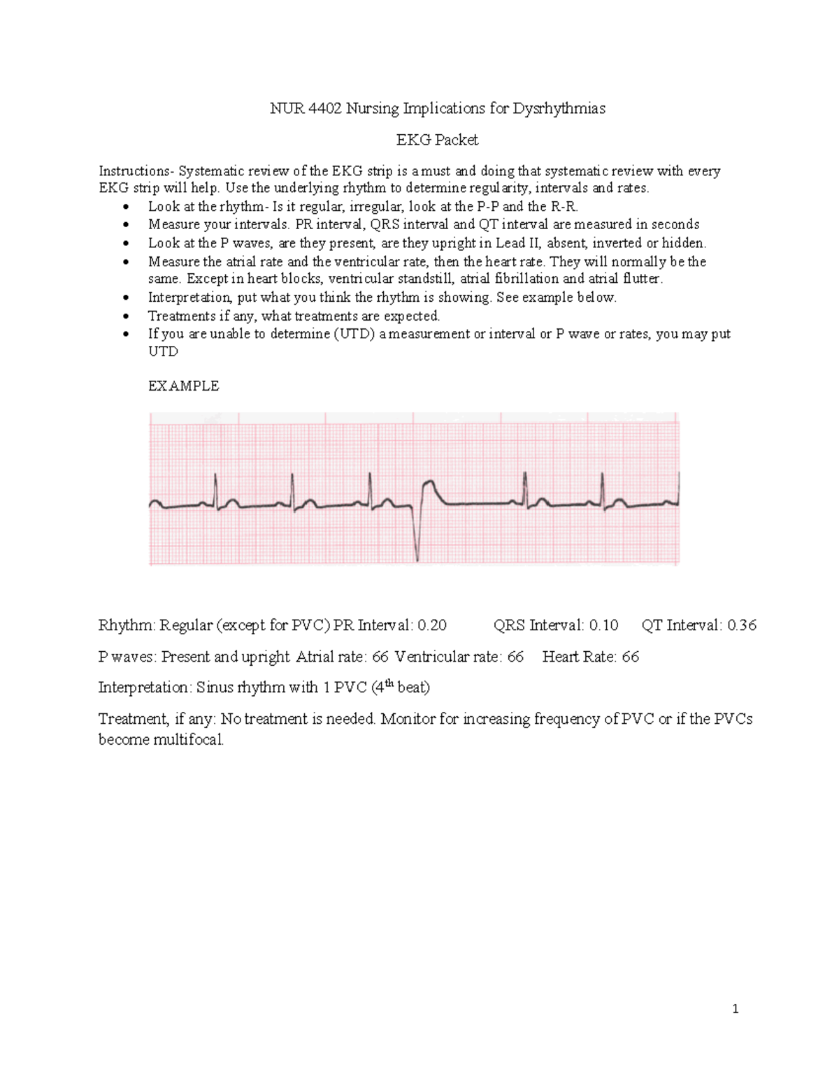 Rhythm strip template - NUR 4402 Nursing Implications for Dysrhythmias ...