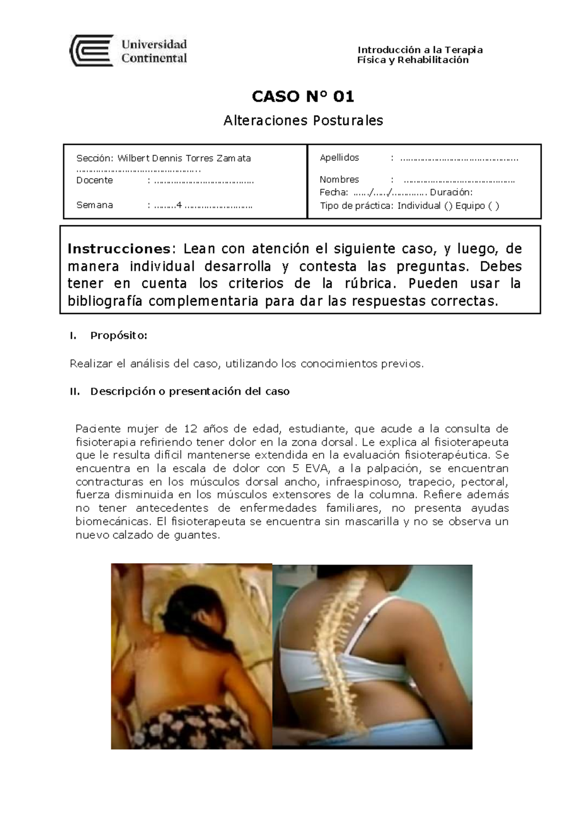 Estudio de Caso01 PA01 - caso clinico 1 -tm - Física y Rehabilitación CASO N° 01 Alteraciones ...