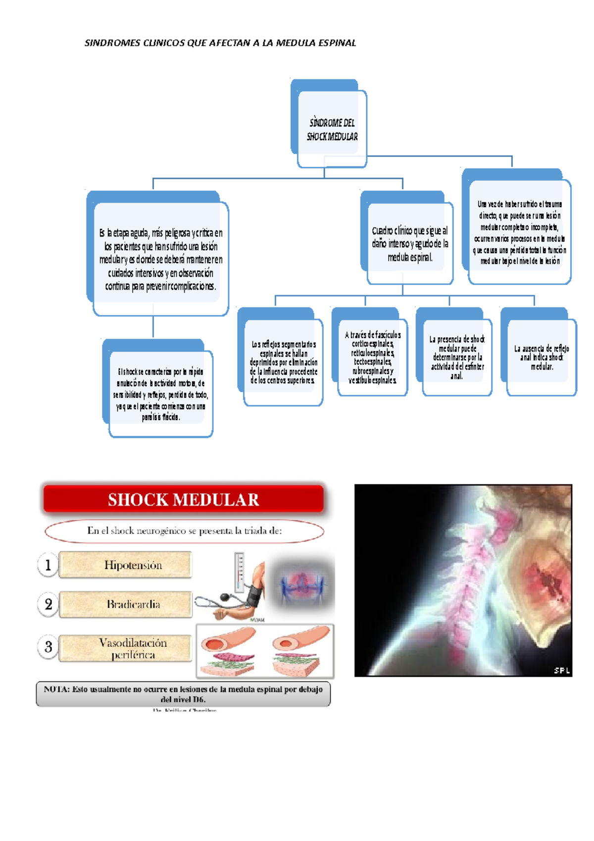 Sindromes Clinicos QUE Afectan A LA Medula Espinal. Pamela Veriñaz ...