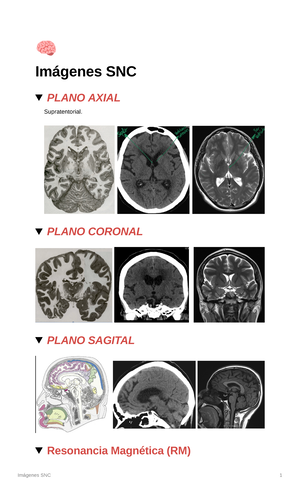Anatomía Radiológica SNC 1 - Anatomía Radiológica SNC Desarrollo de Tejido Nervioso, SNC de las ...