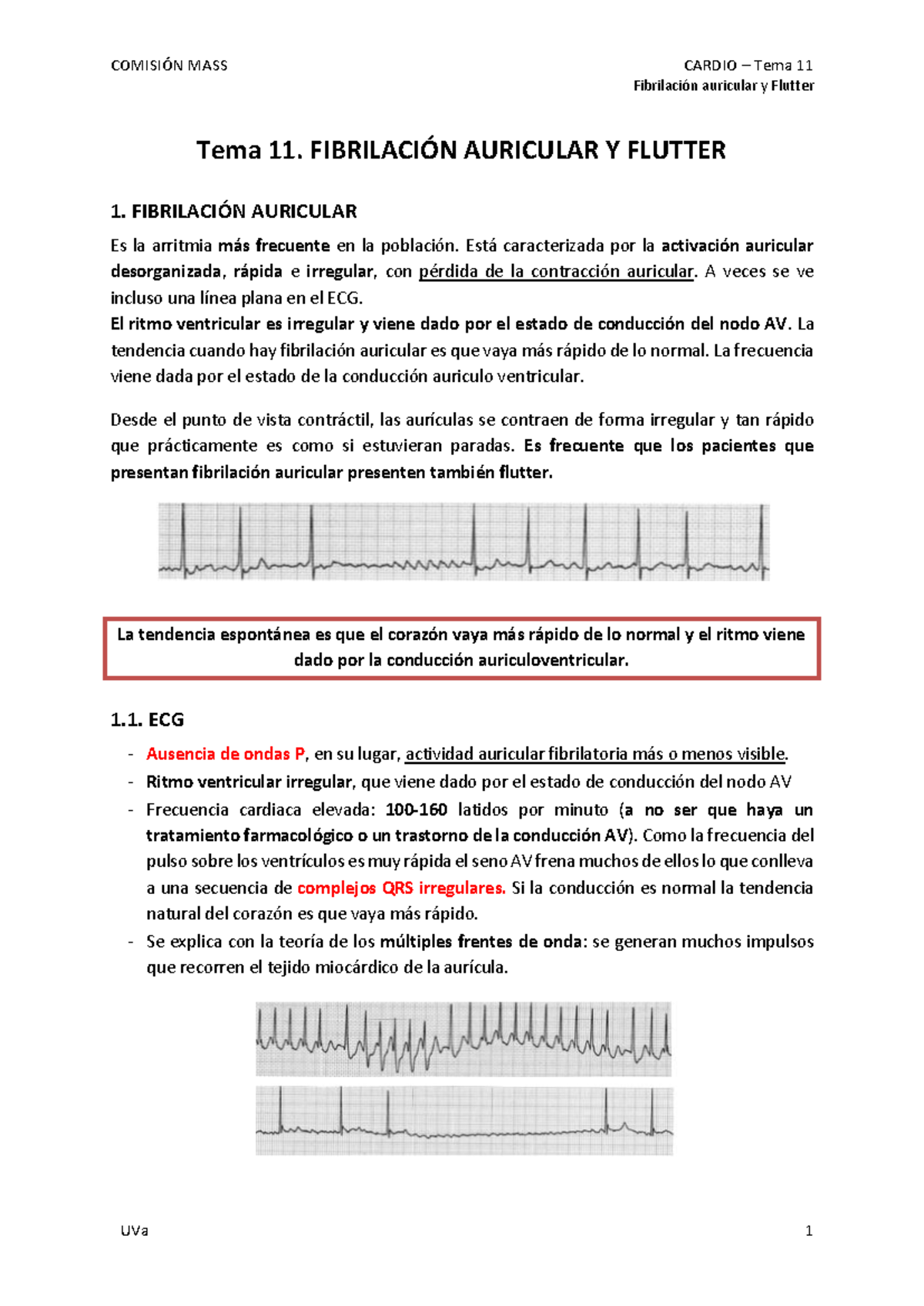 Tema 11. Arritmias IV. Fibrilación auricular y flutter - Fibrilación ...