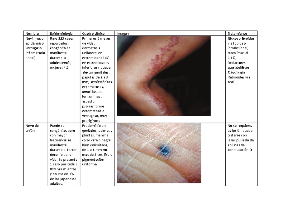 Nevos tabla - Nombre Epidemiologia Cuadro clinico Imagen Tratamiento ...