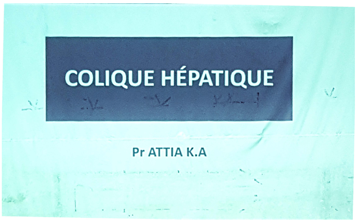 Colique hepatique - COLIQUE HÉPATIQUE ! -· Pr ATTIA K l ' .. Objectifs ...