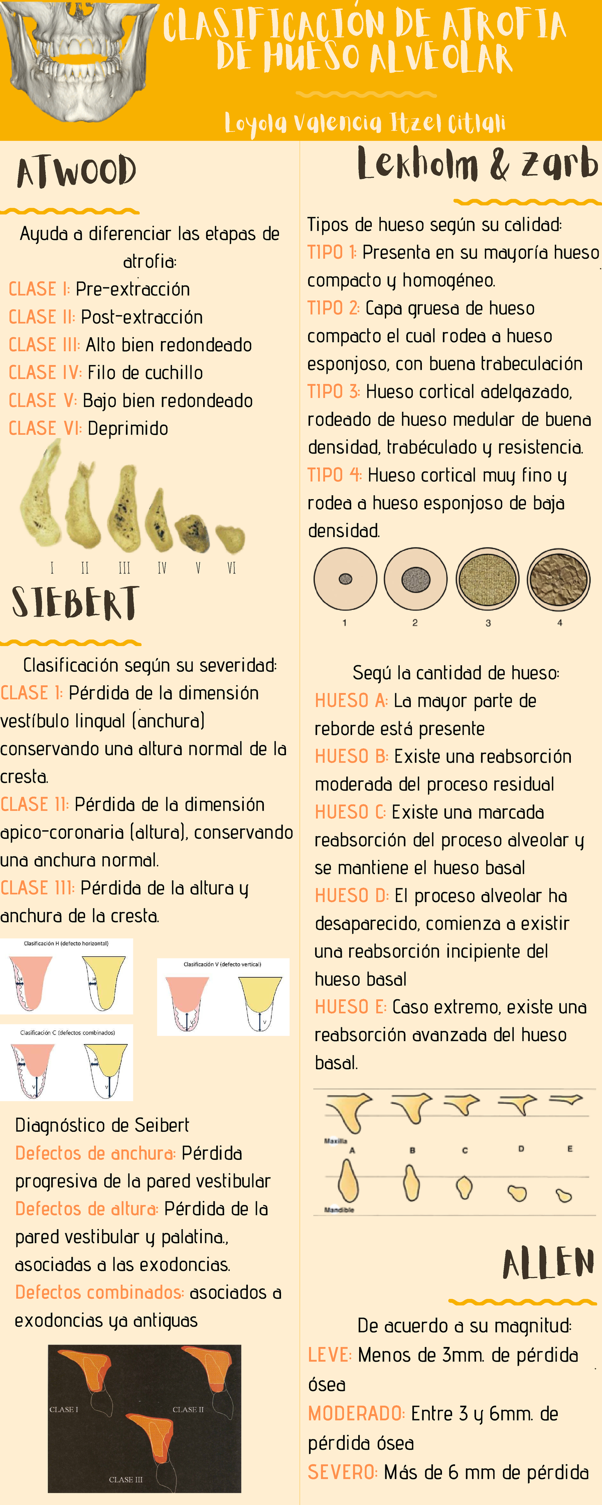 Clasificación de Atrofia DE Hueso Alveolar - CLASIFICACIÓN DE ATROFIA ...