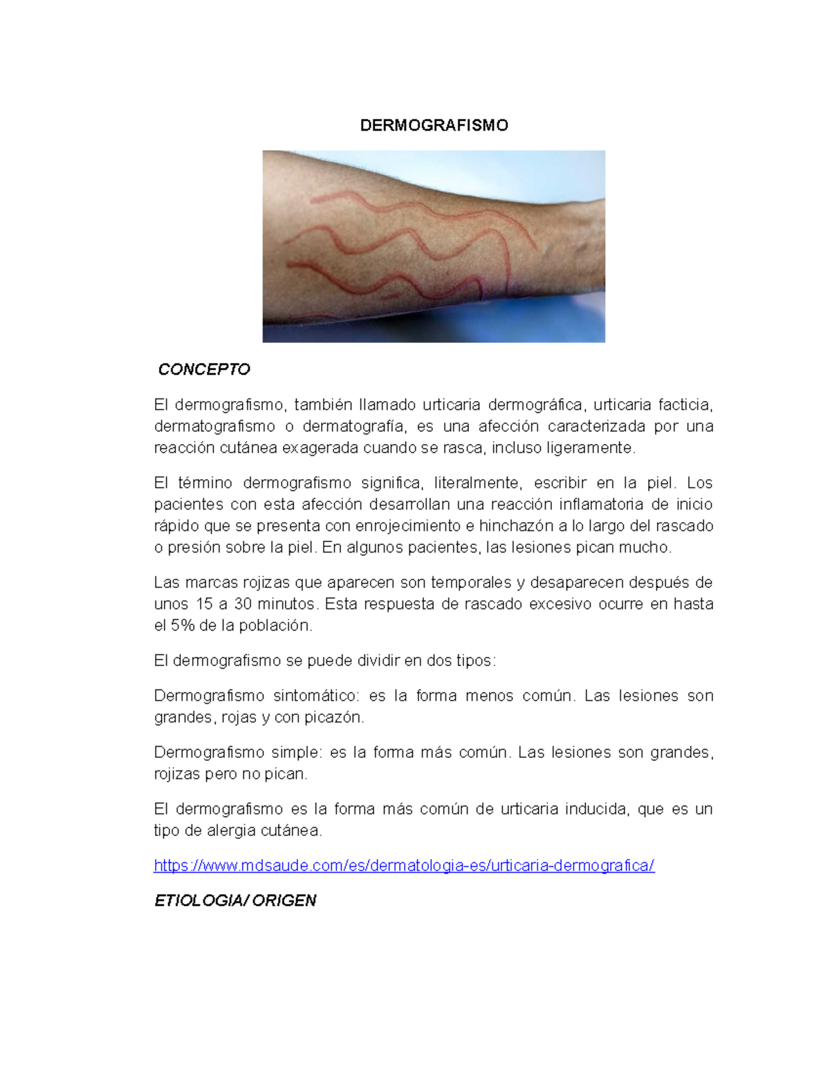 Urticaria Dermografismo - DERMOGRAFISMO CONCEPTO El dermografismo ...