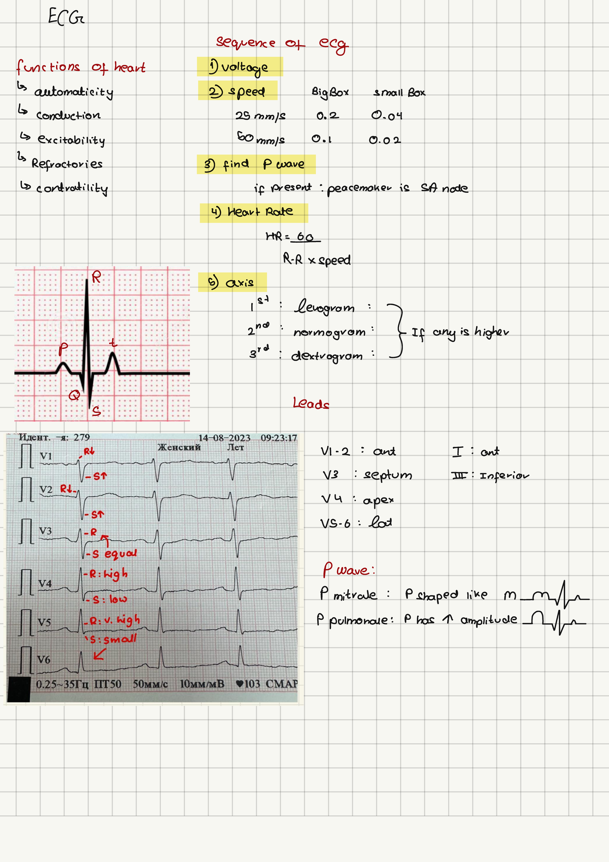 ECG (cheat sheet) - Internal Disease - Studocu