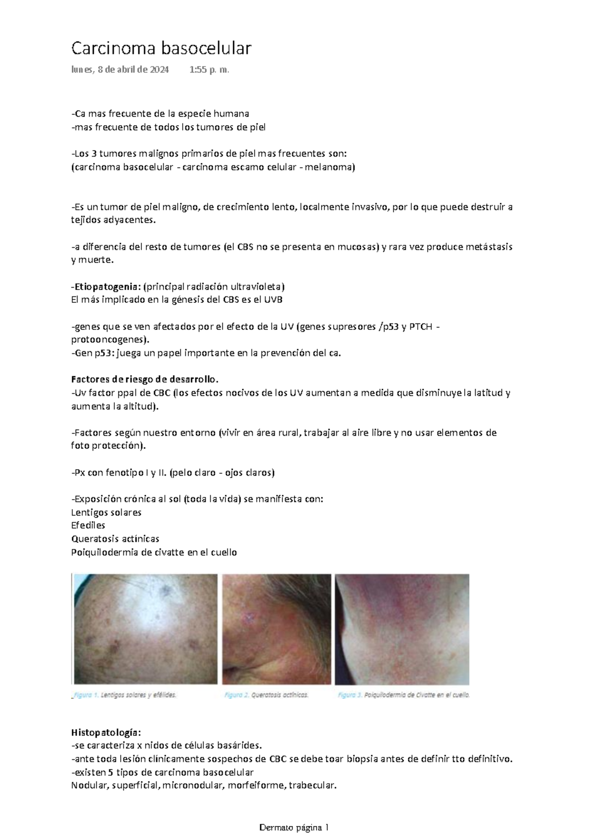 Carcinoma basocelular - Ca mas frecuente de la especie humana mas ...