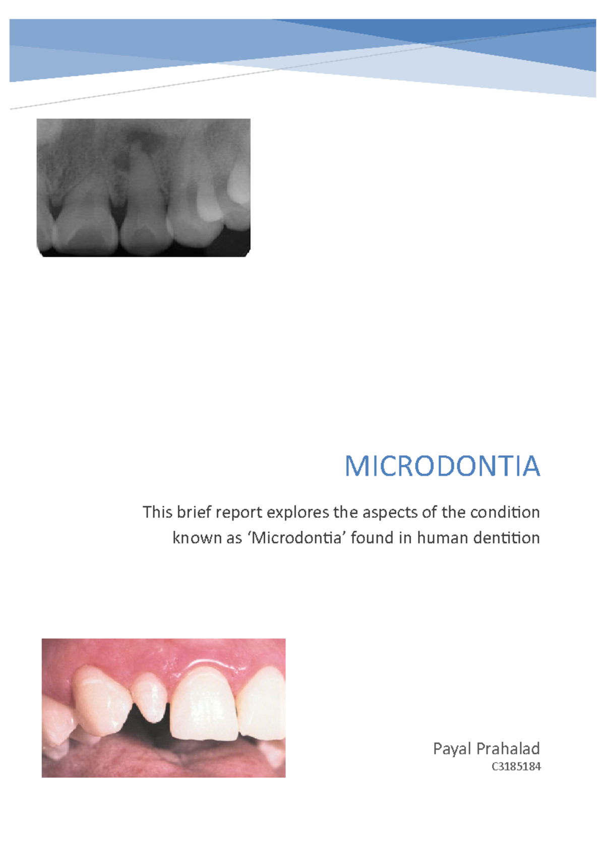 Microdontia report 1001 - MICRODONTIA This brief report explores the ...