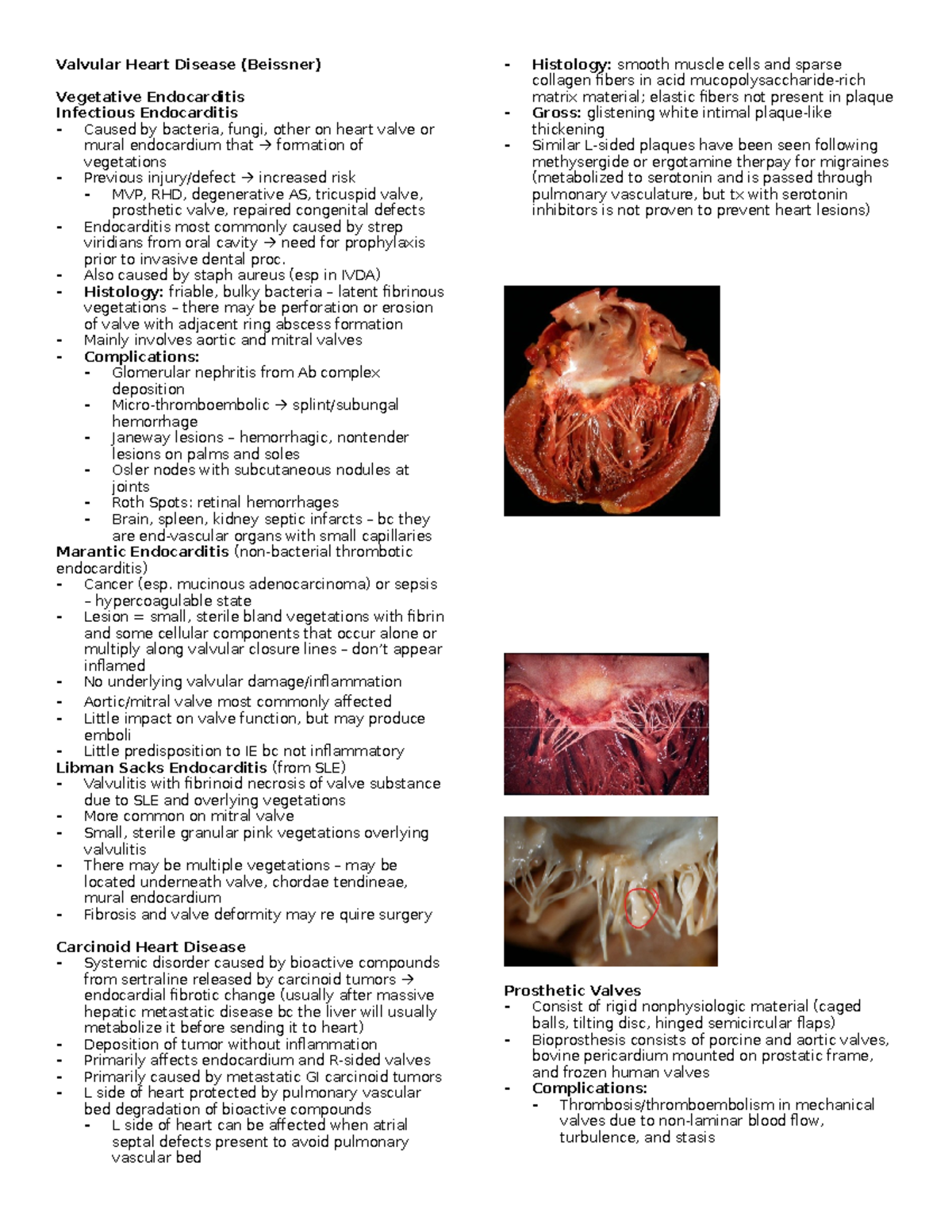 Valvular Heart Disease (Beissner) - Valvular Heart Disease (Beissner ...