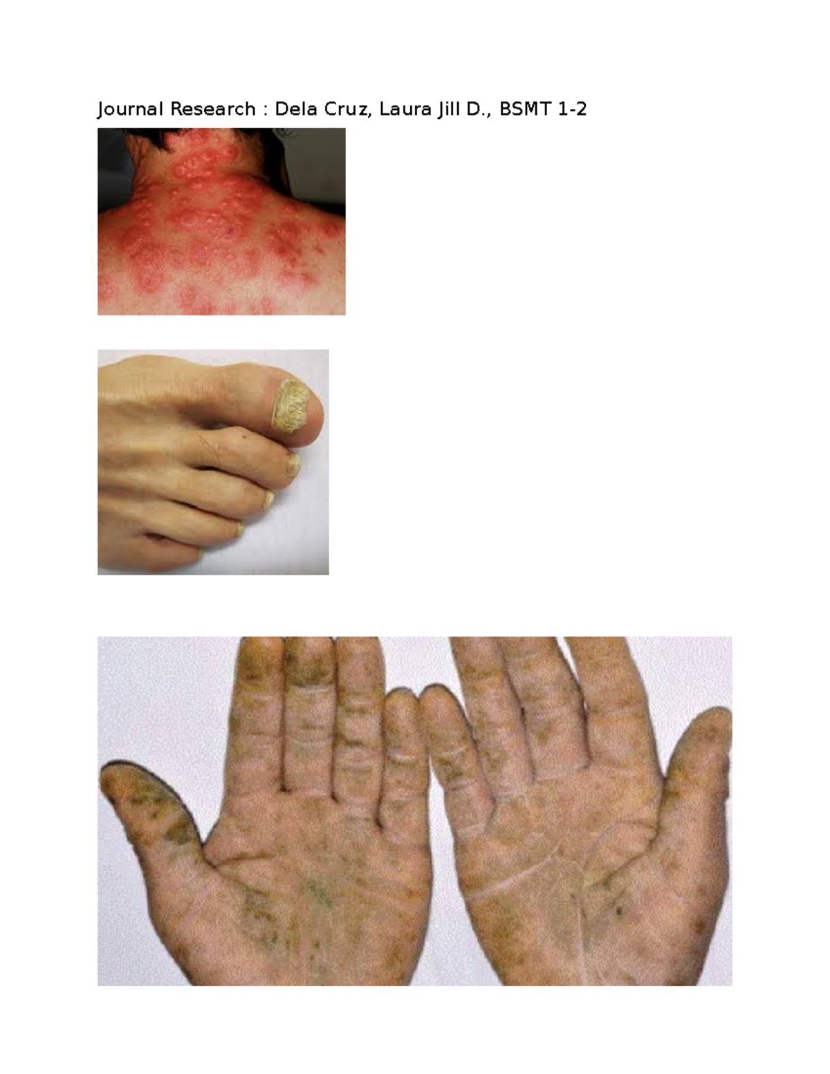 Week 4-Journal Research on Tissue Pathology - Dela Cruz, Laura Jill D ...