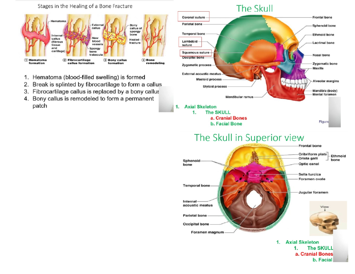 Bones - Skeletal System - Stages in the Healing of a Bone Fracture The ...