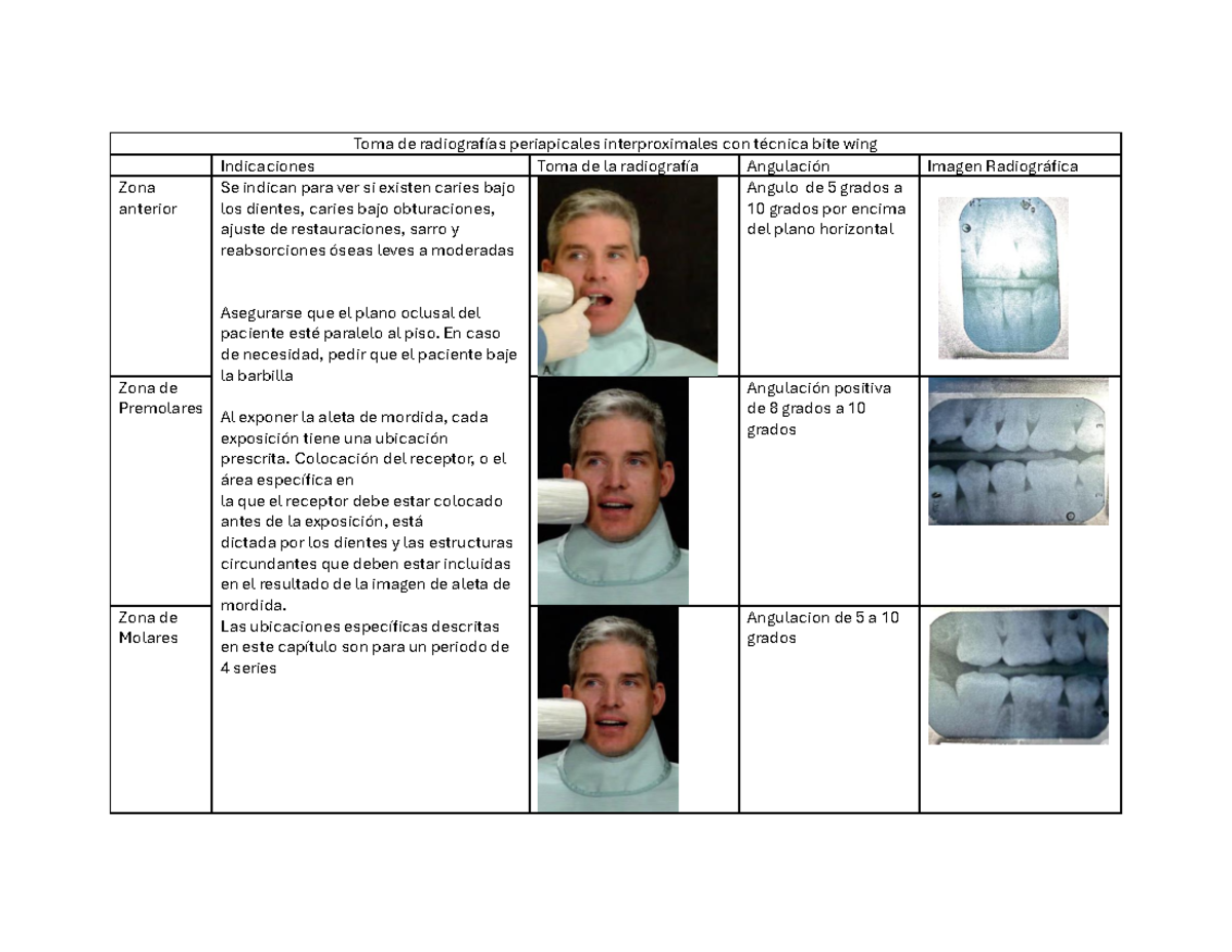 Toma de radiografías periapicales interproximales con técnica bite wing ...