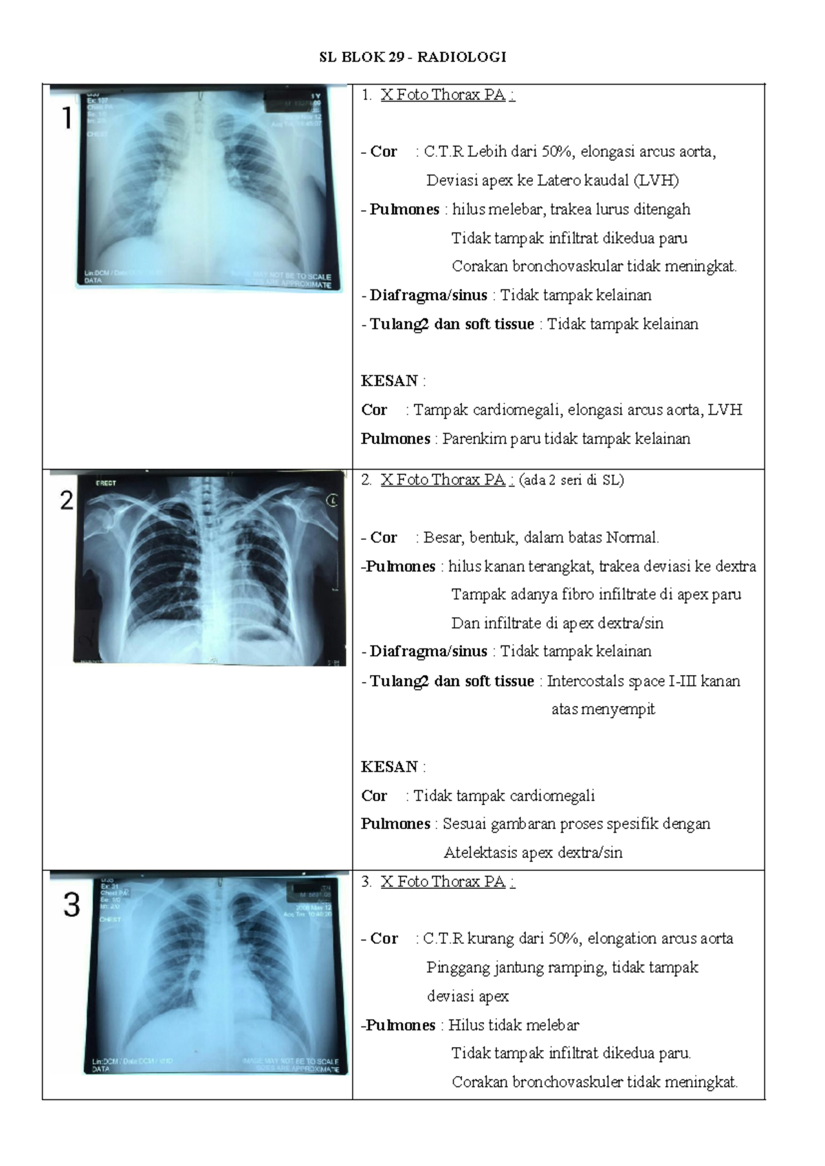 Word rontgen - SL BLOK 29 - RADIOLOGI 1. X Foto Thorax PA : - Cor : C.T ...