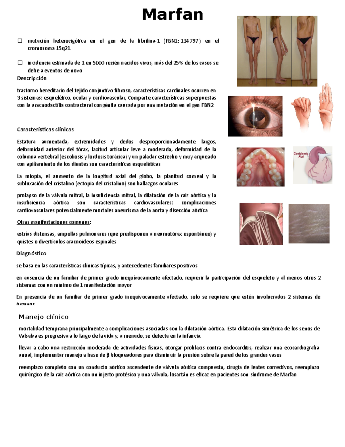 Sindrome de Marfan, Genetica Clinica - mutación heterocigótica en el ...