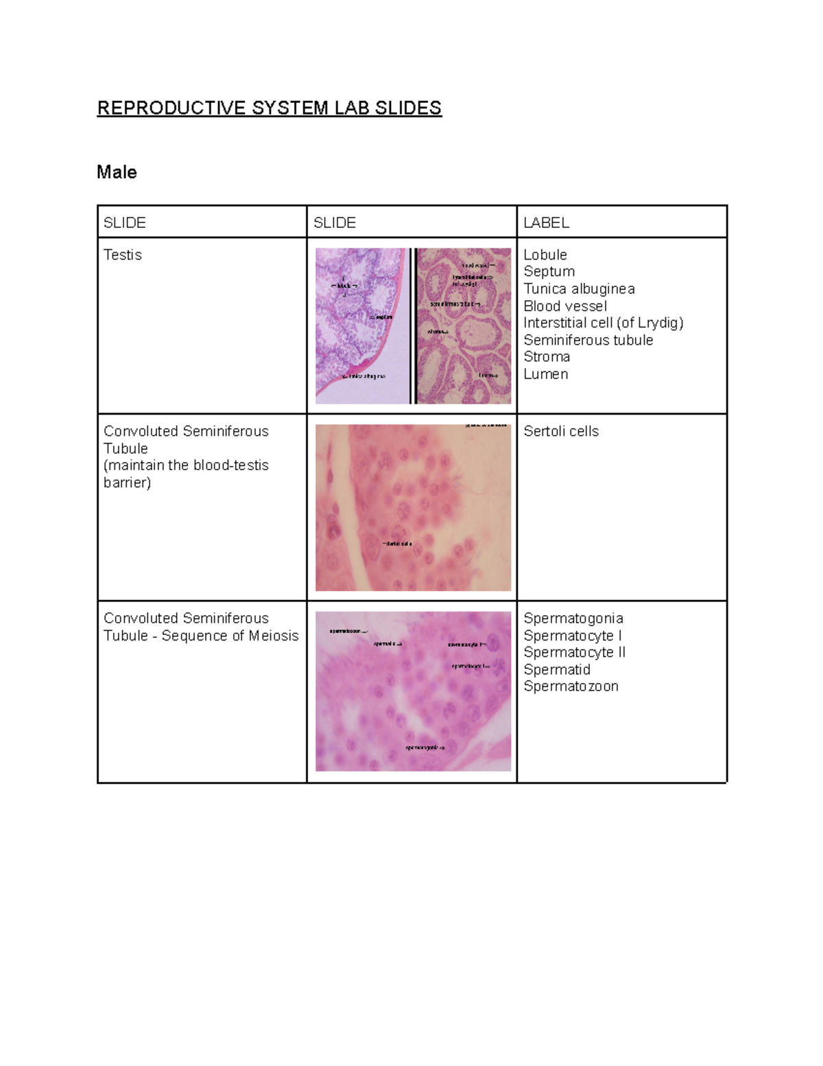 Reproductive System LAB Slides - REPRODUCTIVE SYSTEM LAB SLIDES Male ...
