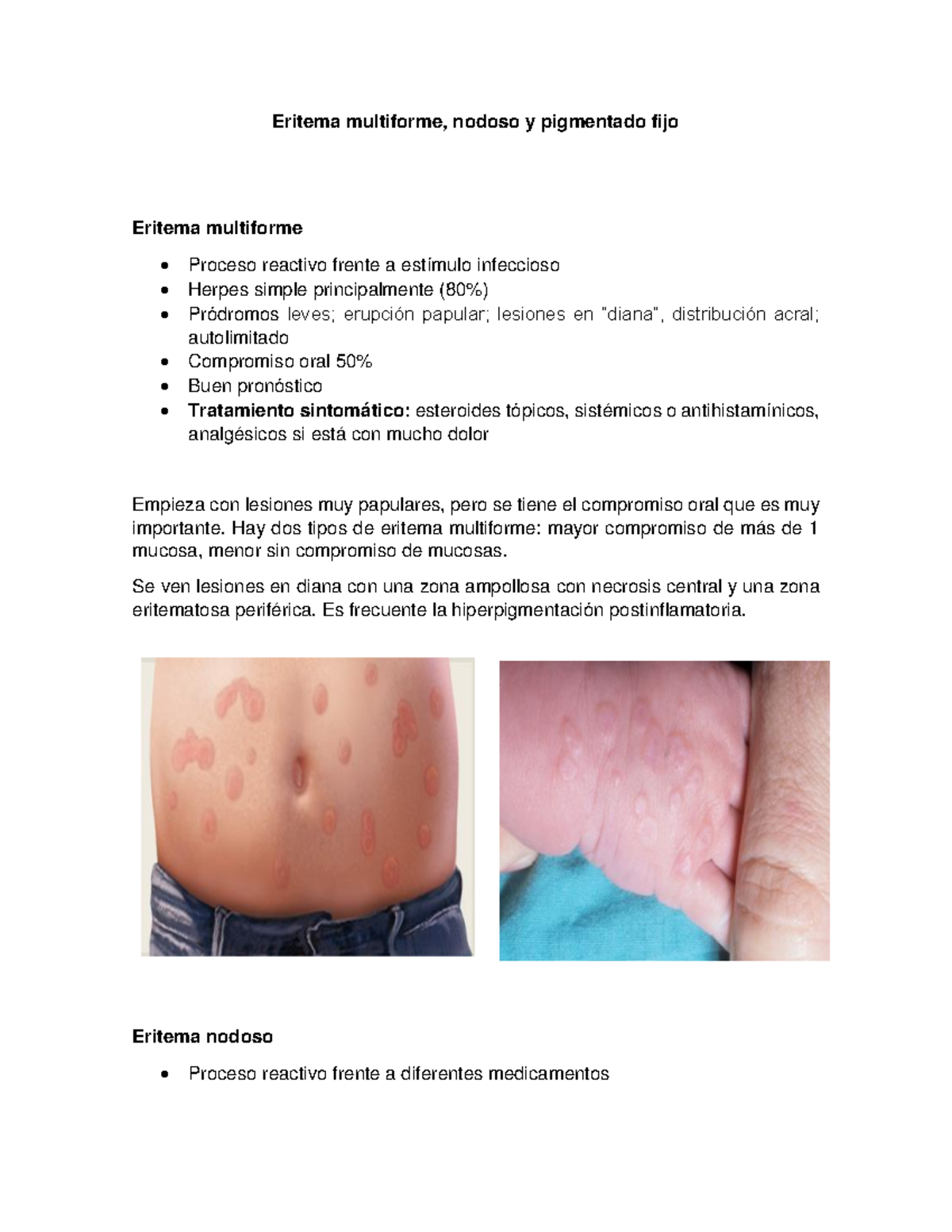 Eritemamultiformehistologiaoral