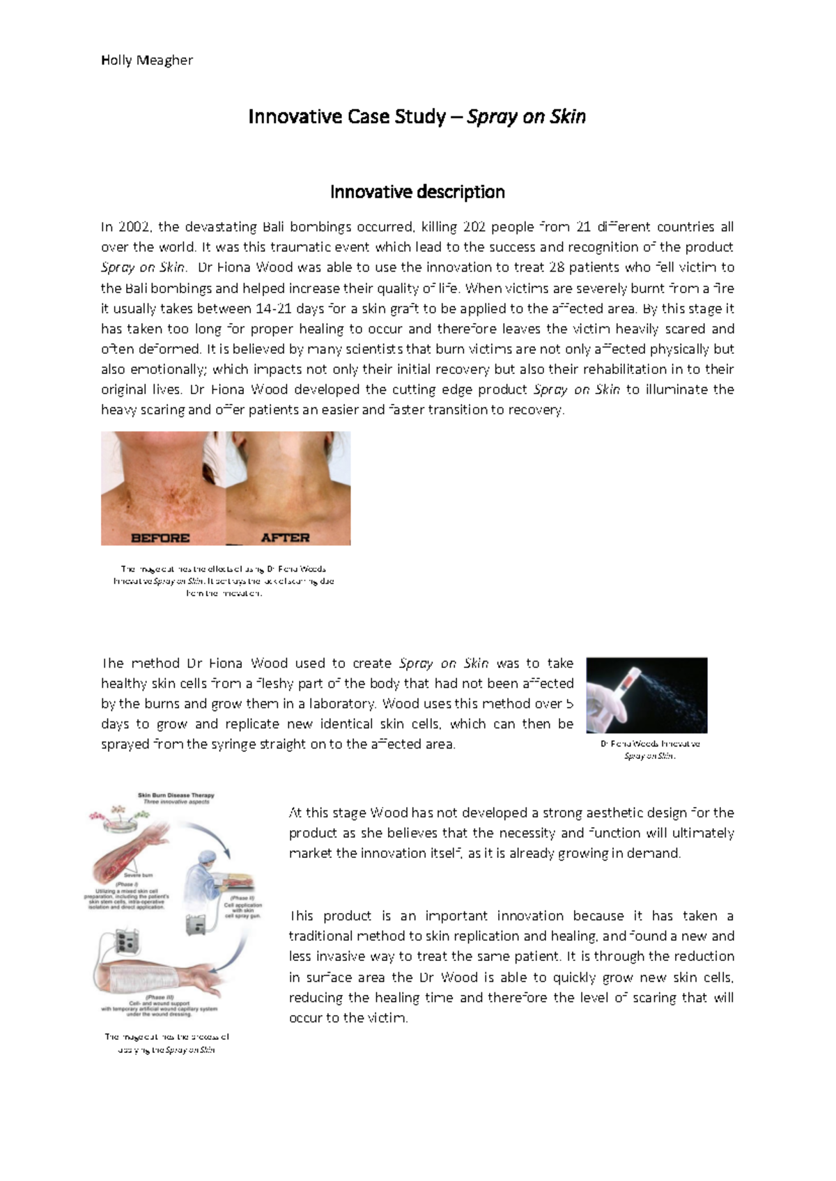 Spray On Skin - bbbb - Holly Meagher Innovative Case Study – Spray on ...