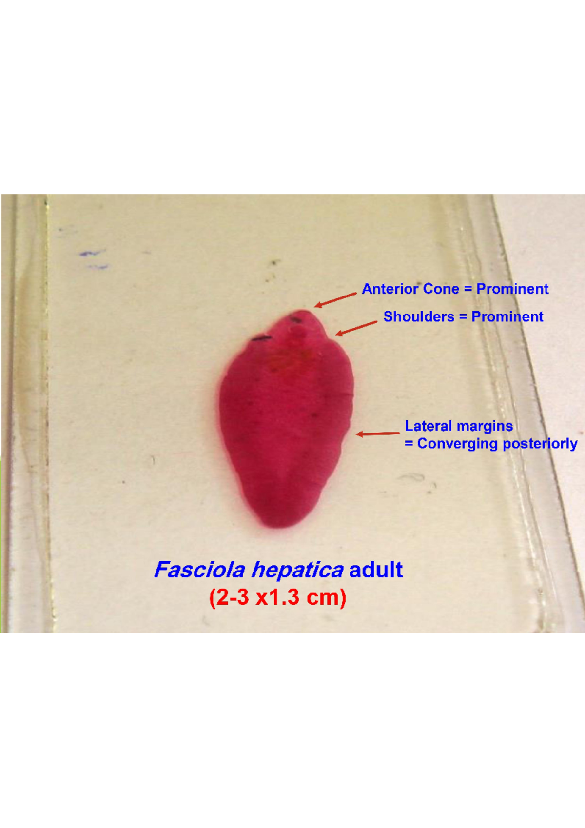 Fasciola hepatica adult and other adult worm - Parasitology - Studocu