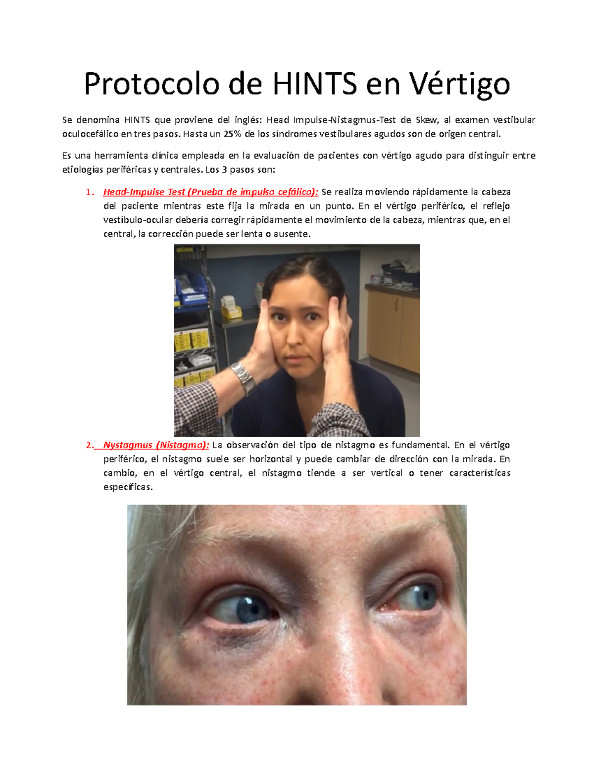 Protocolo Hints - Semiología para evaluar el tipo de Vértigo. - Se ...