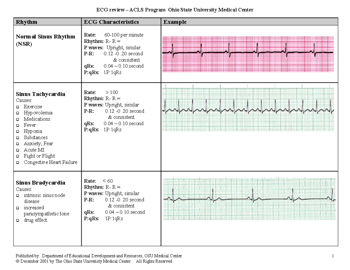 Exam 3 EKG examples - Idk - ECG review – ACLS Program Ohio State ...