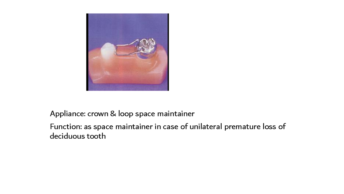 4 - Pedo - Appliance: crown & loop space maintainer Function: as space ...