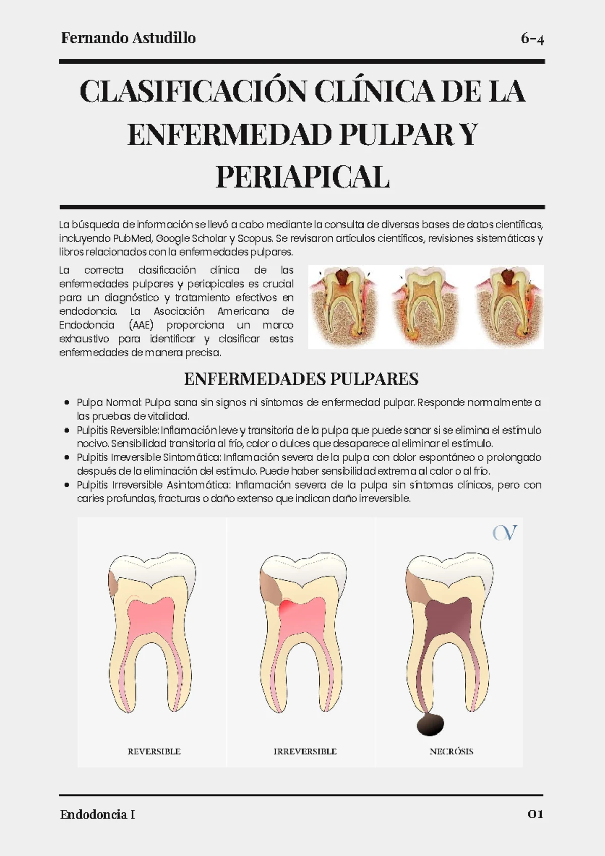 Clasificación histopatológica de la enfermedad pulpar y periapical - Clasificación ...