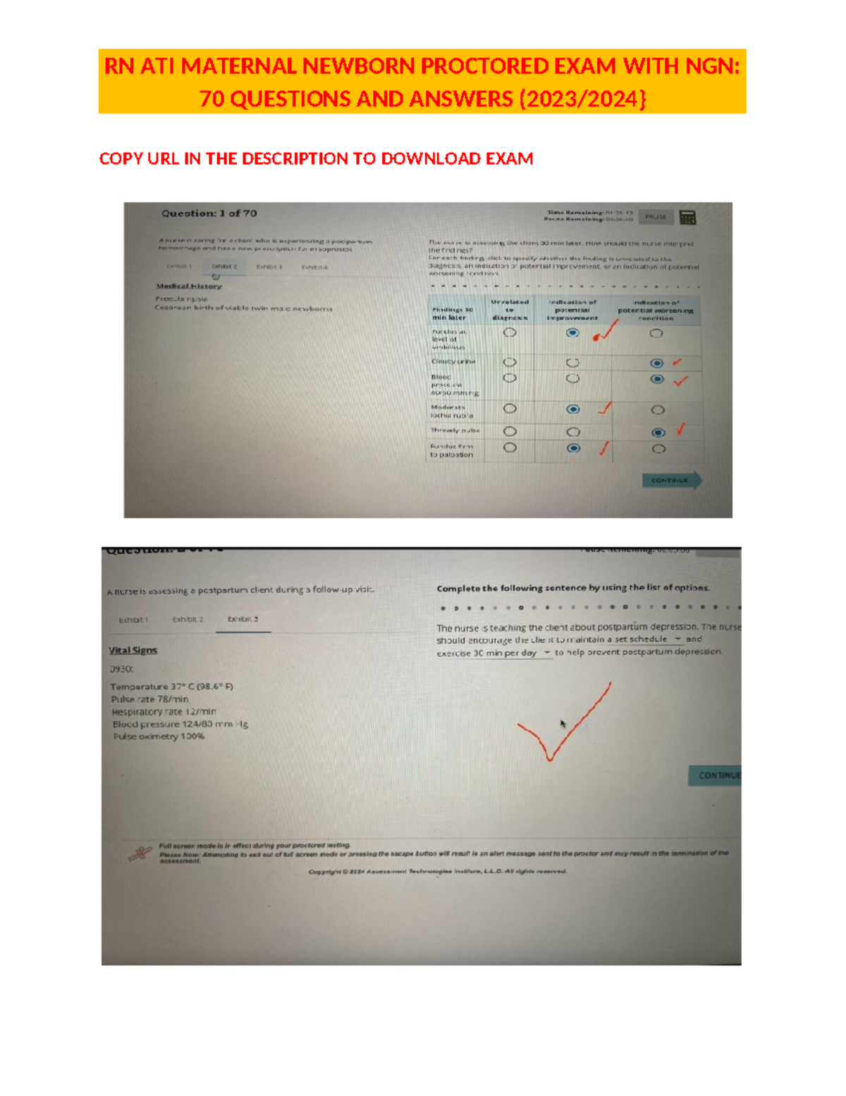 Comprehensive CMS RN Maternal Newborn 2024 Proctored Exam with NGN - RN ...