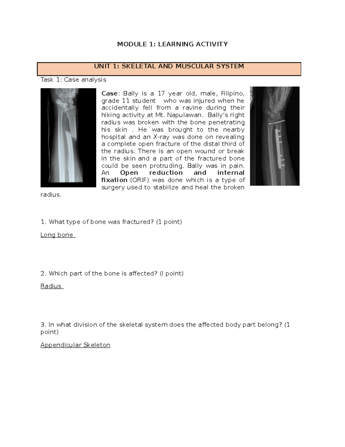 Skeletal and Muscular System Quiz - MODULE 1: LEARNING ACTIVITY UNIT 1 ...
