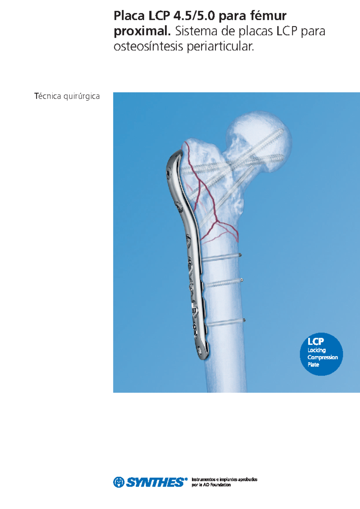 Placas para femur proximal - Placa LCP 4.5/5 para fémur proximal. Sistema de placas LCP para ...
