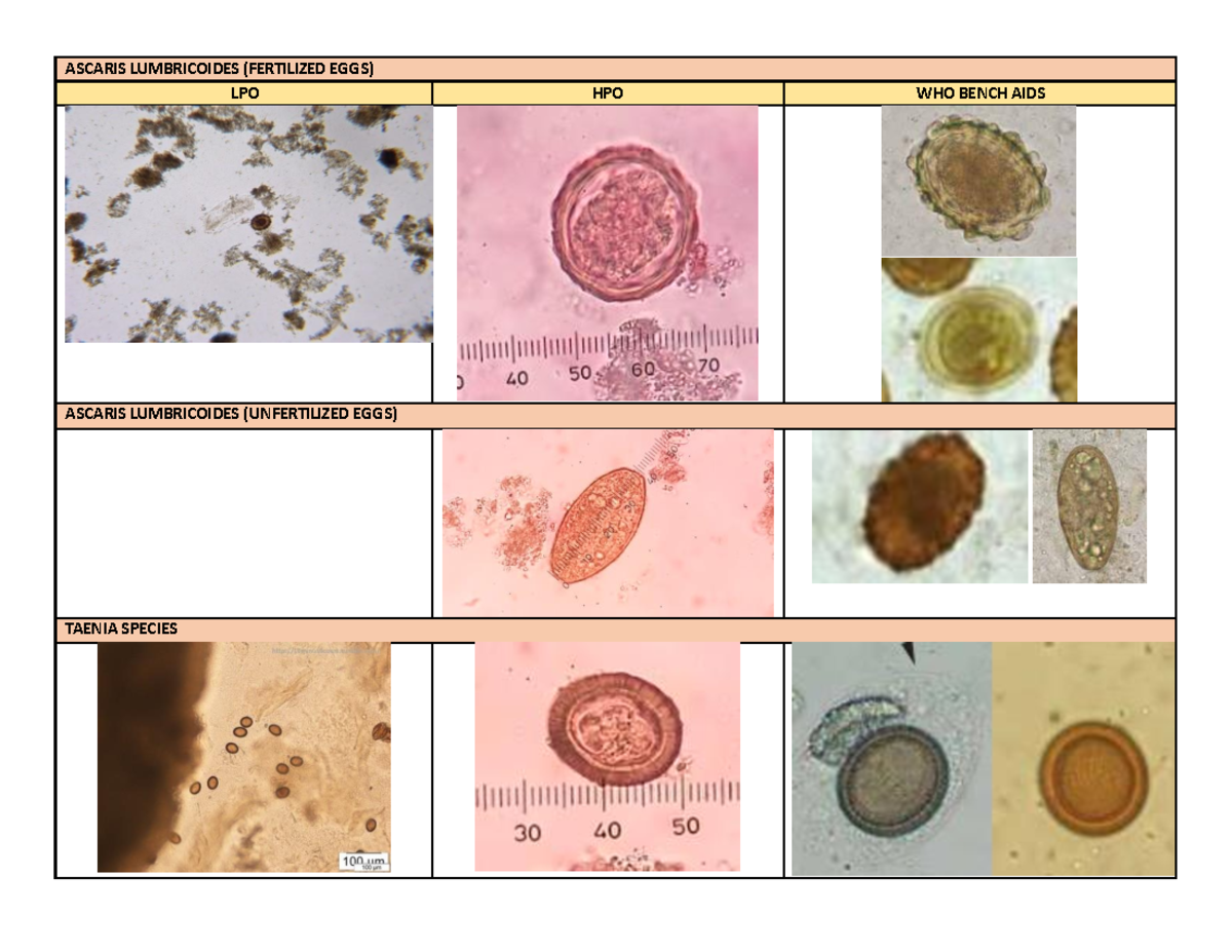 Helminths - n/a - medical laboratory sciences - ASCARIS LUMBRICOIDES ...
