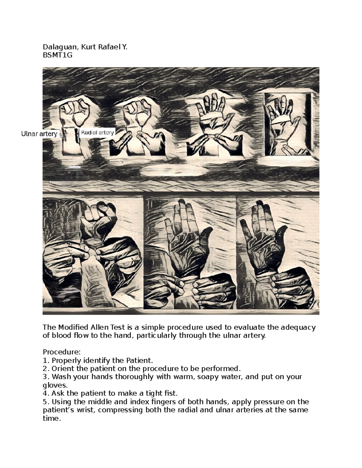 Dalaguan Kurt Rafael Allen Test - Dalaguan, Kurt Rafael Y. BSMT1G The ...