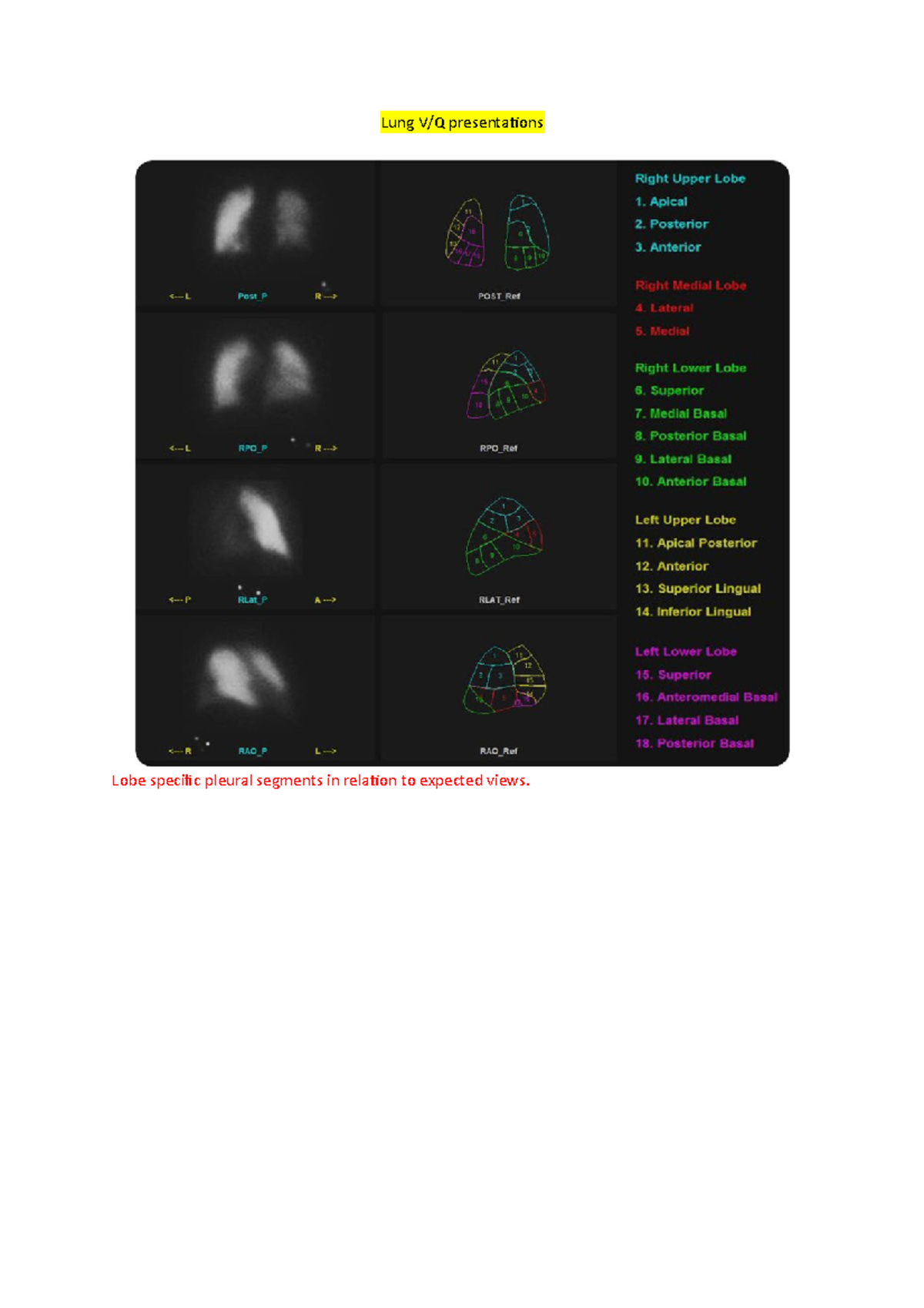 Lung V scan app - iojjn j - Lung V/Q presentations Lobe specific ...