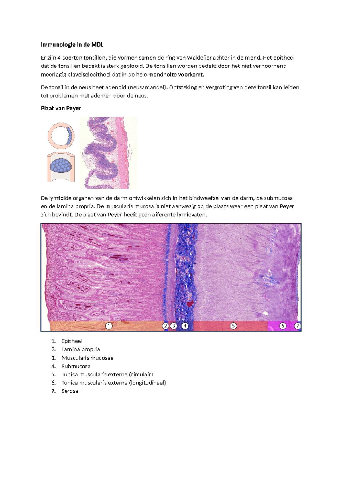 Immunologie in de MDL - Het epitheel dat de tonsillen bedekt is sterk ...