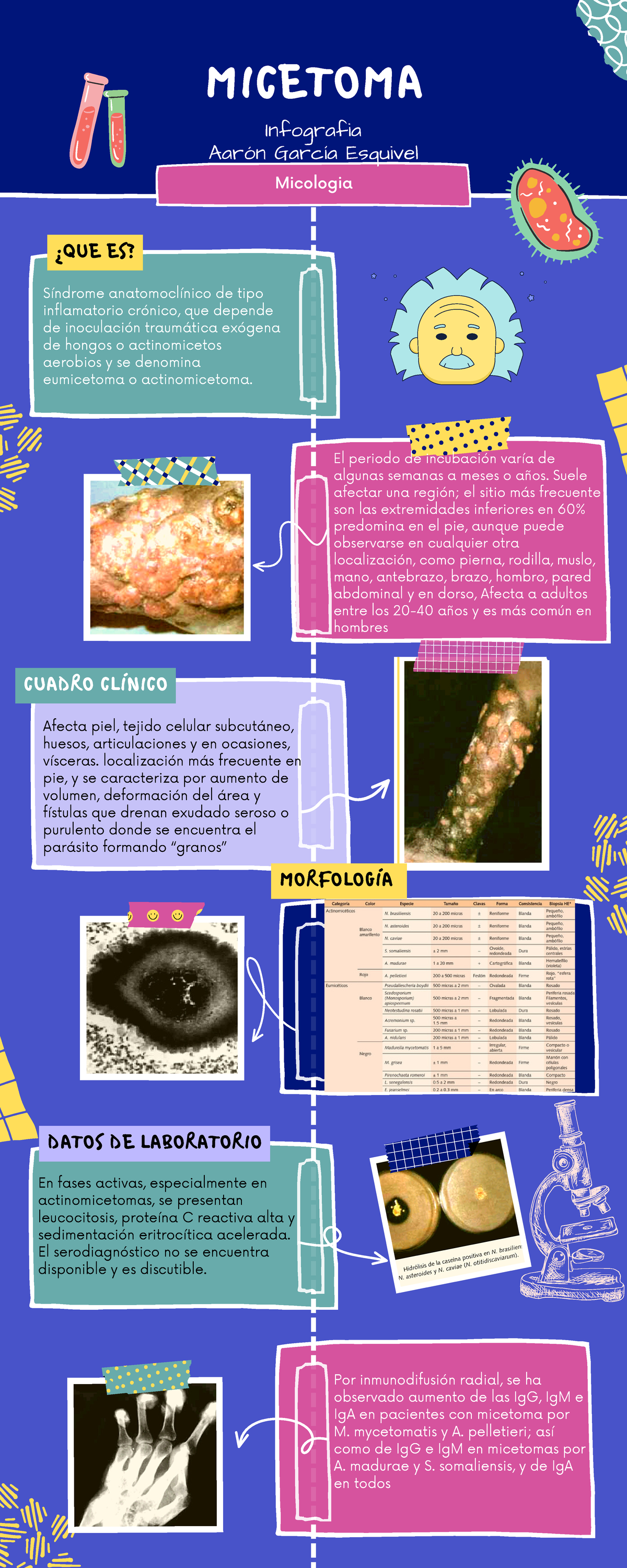 Micetoma - Micologia MICETOMA Infografia Aarón García Esquivel ¿QUE ES ...