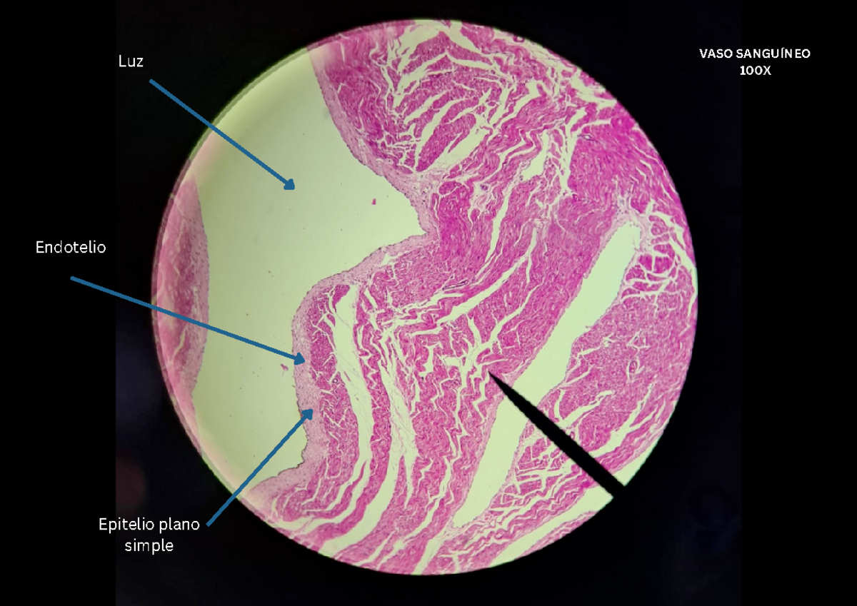 Histología - HISTOO - Luz Epitelio plano simple Endotelio VASO SANGUÍNEO 100X TIROIDES 400X ...